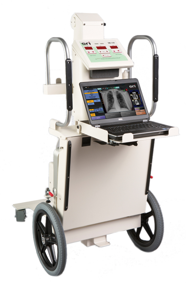 Portable Digital X-ray - Mobile Quality Diagnostic